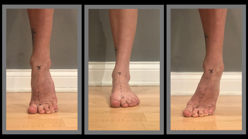 Tips to prevent sickling – Allegro Dance Boutique